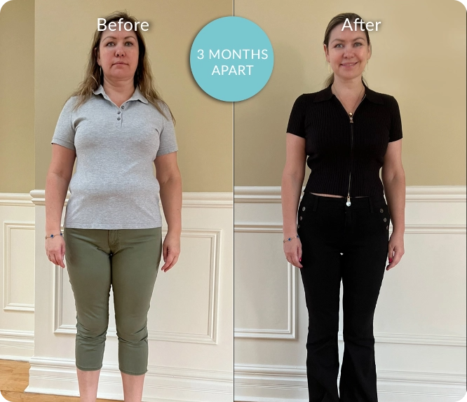 Before & After Photos - Gastric Sleeve Surgery - 360 Sleeve