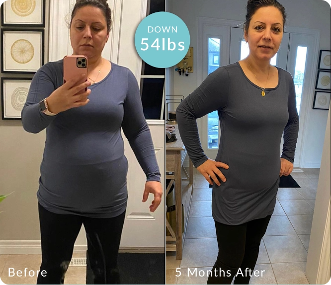 Before & After Photos - Gastric Sleeve Surgery - 360 Sleeve